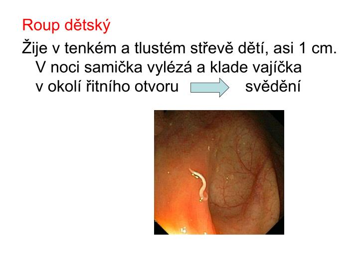 PPT - Parazité člověka Přírodopis 7. třída PowerPoint Presentation - ID ...