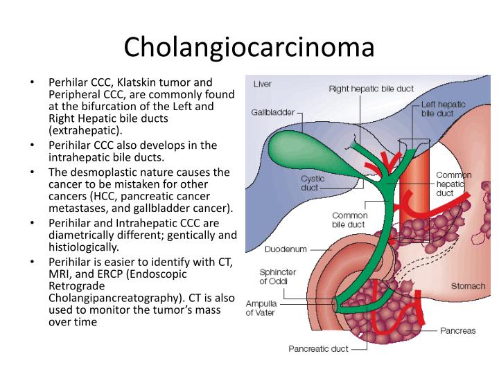 PPT - Monitoring Cholangiocarcinoma with F18-FDG PET/CT imaging ...