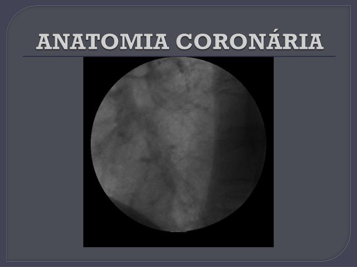PPT - ANATOMIA CORONÁRIA PowerPoint Presentation - ID:4454234