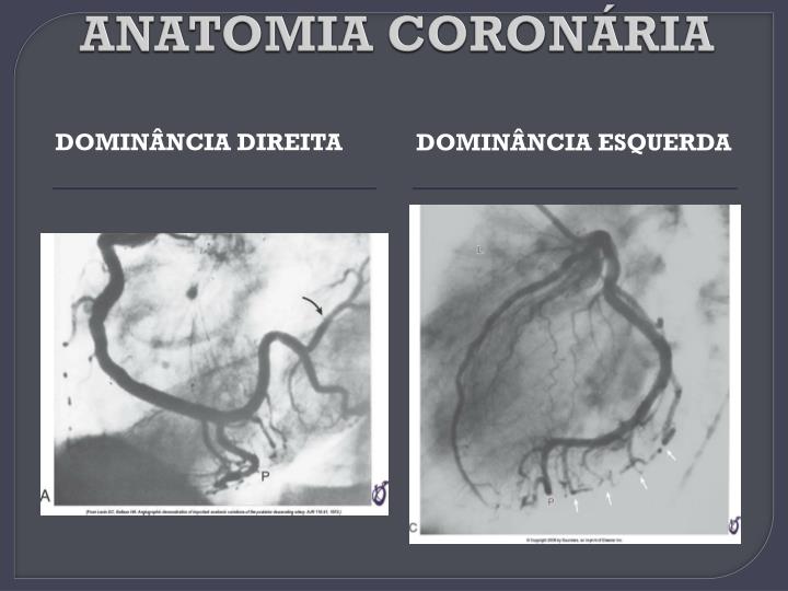 PPT - ANATOMIA CORONÁRIA PowerPoint Presentation - ID:4454234