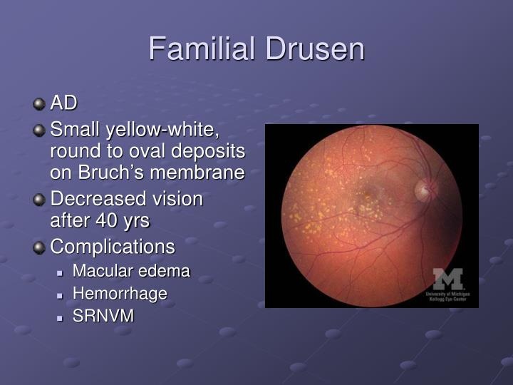 PPT - Vitreous and Retina Pediatric Ophthalmology PowerPoint ...