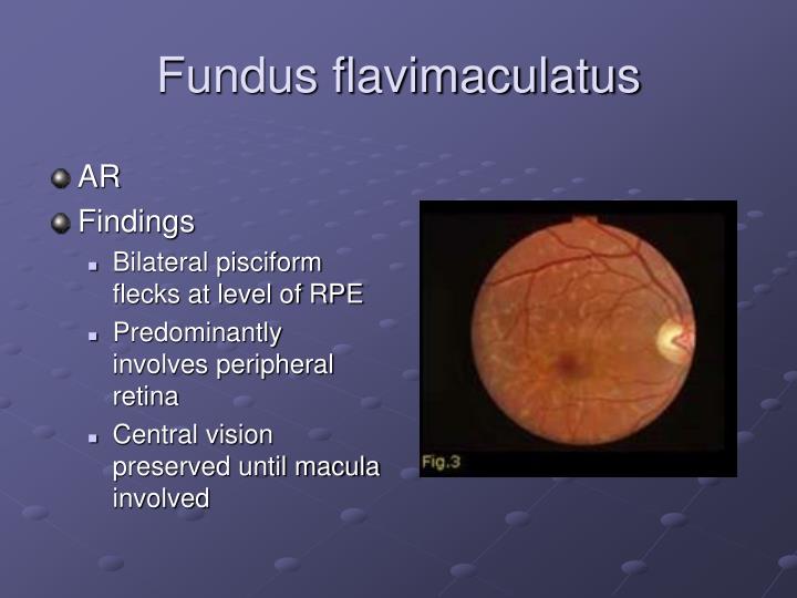 PPT - Vitreous and Retina Pediatric Ophthalmology PowerPoint ...