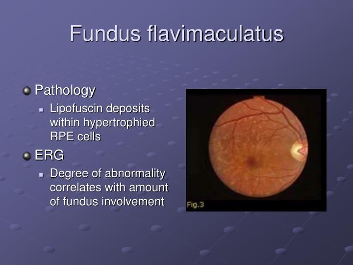 PPT - Vitreous and Retina Pediatric Ophthalmology PowerPoint ...