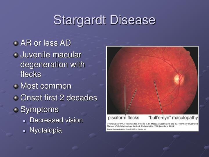 PPT - Vitreous and Retina Pediatric Ophthalmology PowerPoint ...