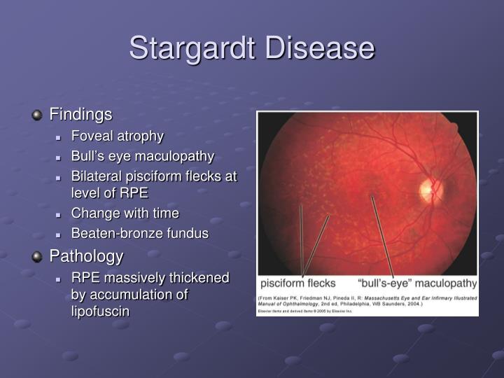 PPT - Vitreous and Retina Pediatric Ophthalmology PowerPoint ...