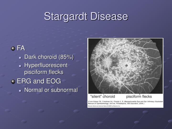 PPT - Vitreous and Retina Pediatric Ophthalmology PowerPoint ...