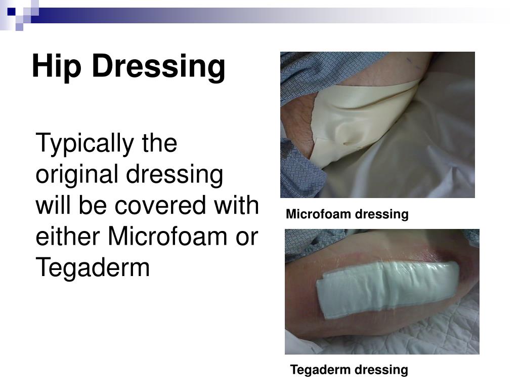 PPT - Establish a Culture of Safety: Working Toward Zero Surgical Site ...