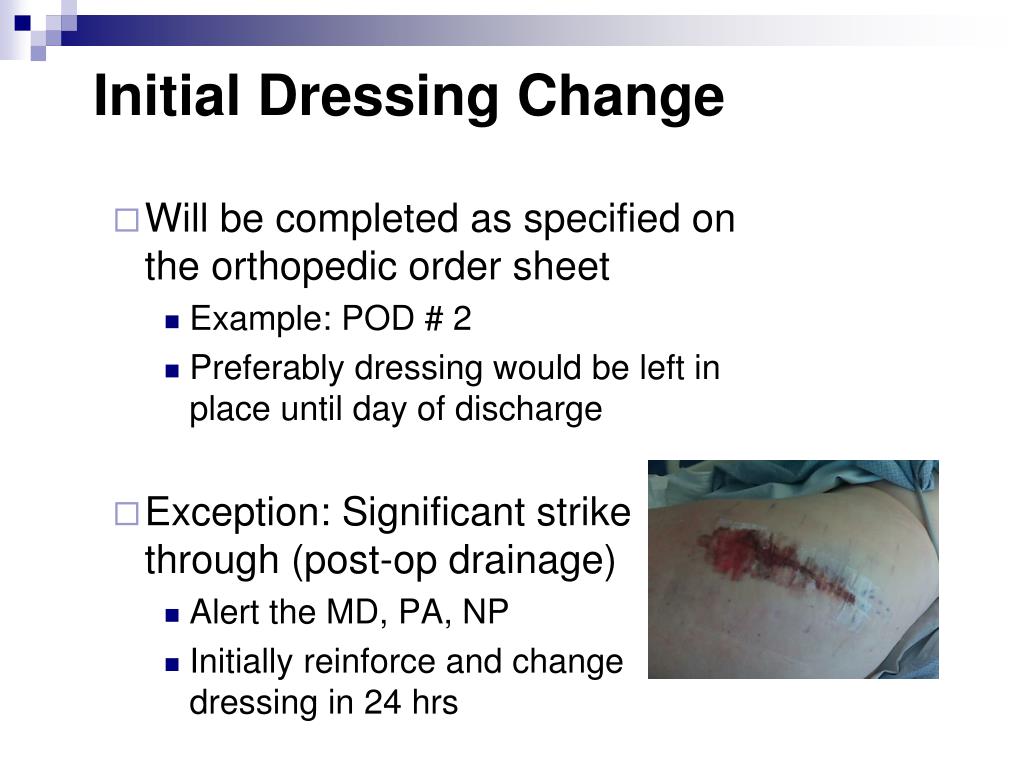 PPT - Establish a Culture of Safety: Working Toward Zero Surgical Site ...