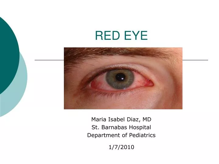 PPT - RED EYE PowerPoint Presentation, free download - ID:4462254