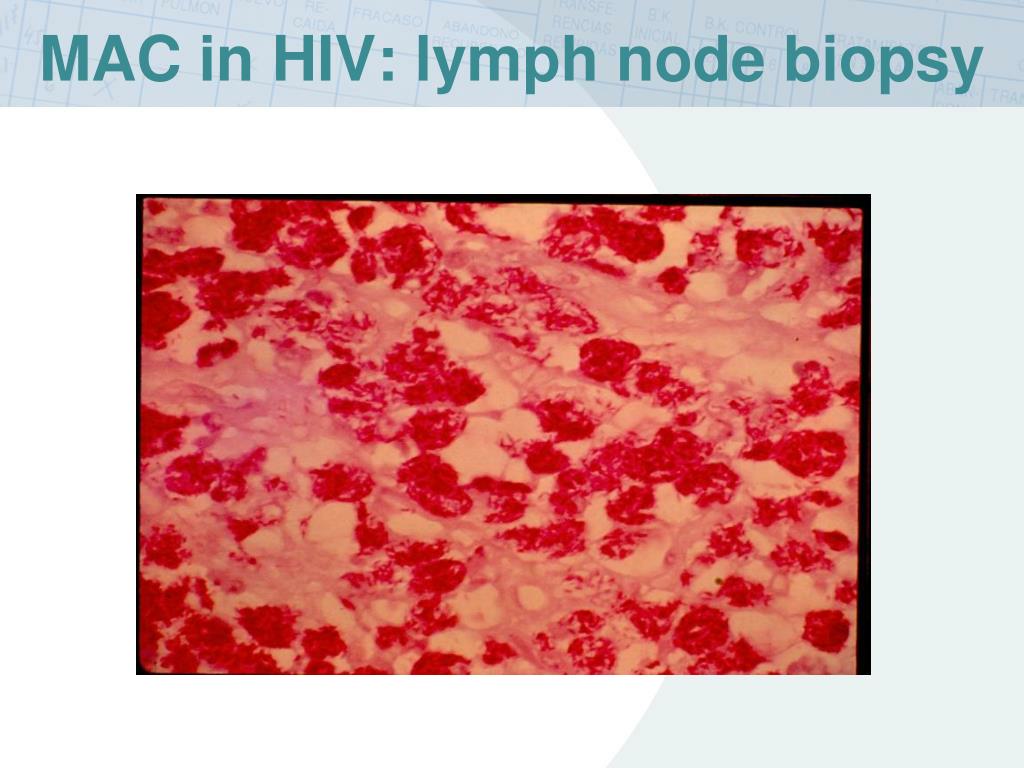 PPT - Non- tuberculous mycobacteria (NTMs) and lung disease Turkish ...