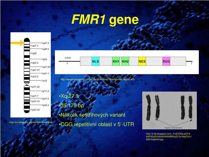 PPT - Syndrom fragilního X chromozómu (FXS) PowerPoint Presentation ...