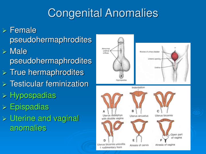 PPT - Development of Genital System PowerPoint Presentation - ID:4470281