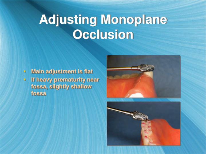 PPT - Setting Posterior Teeth PowerPoint Presentation - ID:4484665