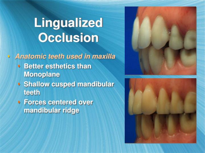 PPT - Setting Posterior Teeth PowerPoint Presentation - ID:4484665