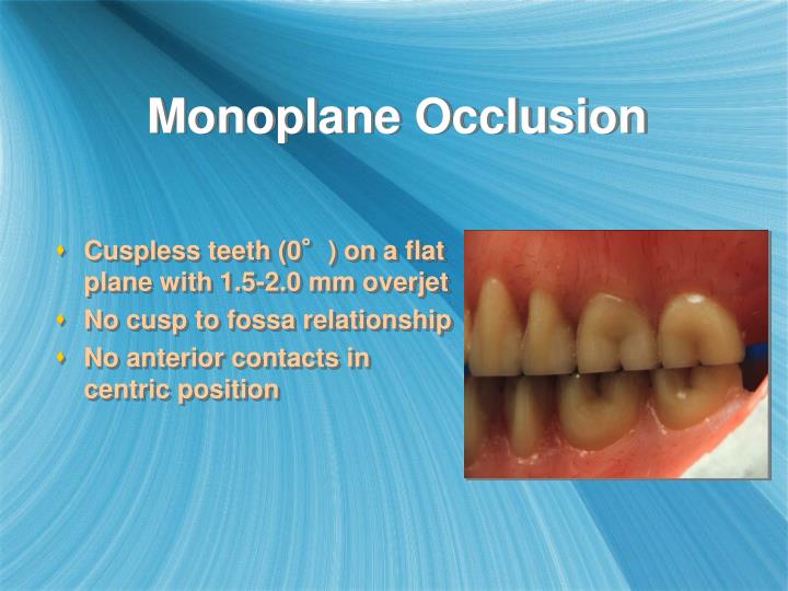 PPT - Setting Posterior Teeth PowerPoint Presentation - ID:4484665