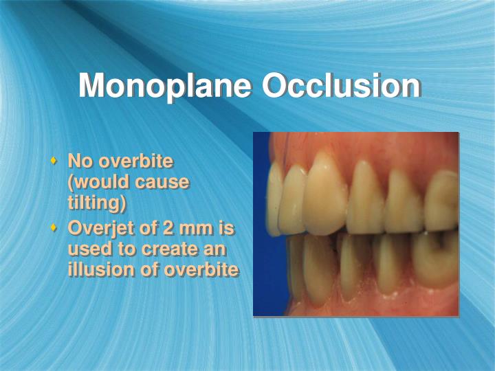 PPT - Setting Posterior Teeth PowerPoint Presentation - ID:4484665