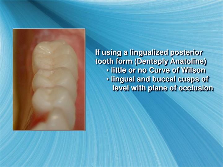 PPT - Setting Posterior Teeth PowerPoint Presentation - ID:4484665