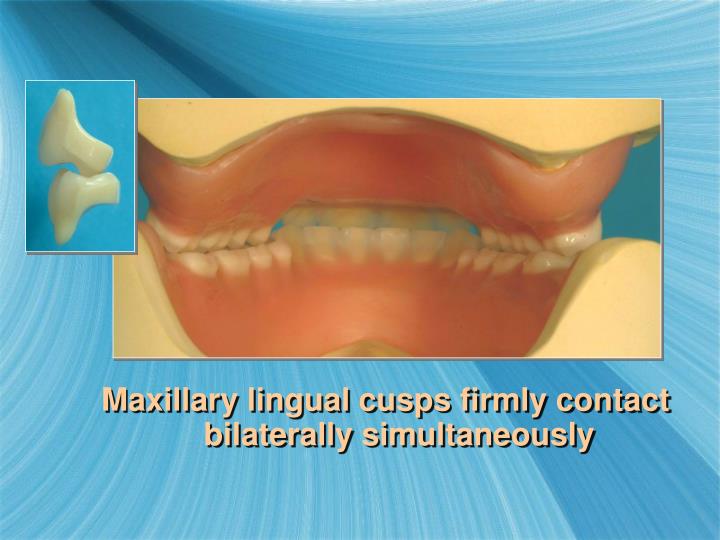 PPT - Setting Posterior Teeth PowerPoint Presentation - ID:4484665