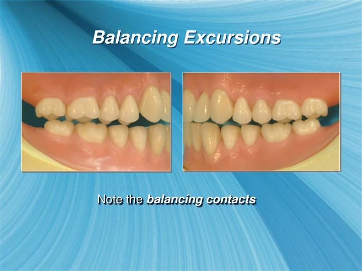 PPT - Setting Posterior Teeth PowerPoint Presentation - ID:4484665
