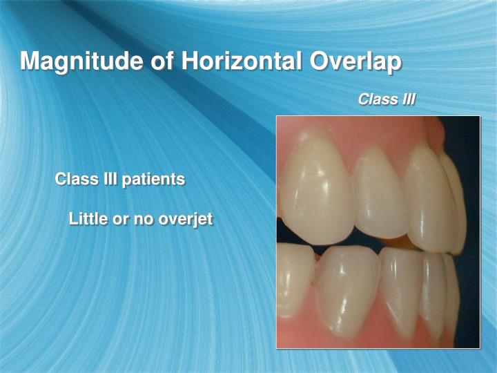 PPT - Setting Posterior Teeth PowerPoint Presentation - ID:4484665