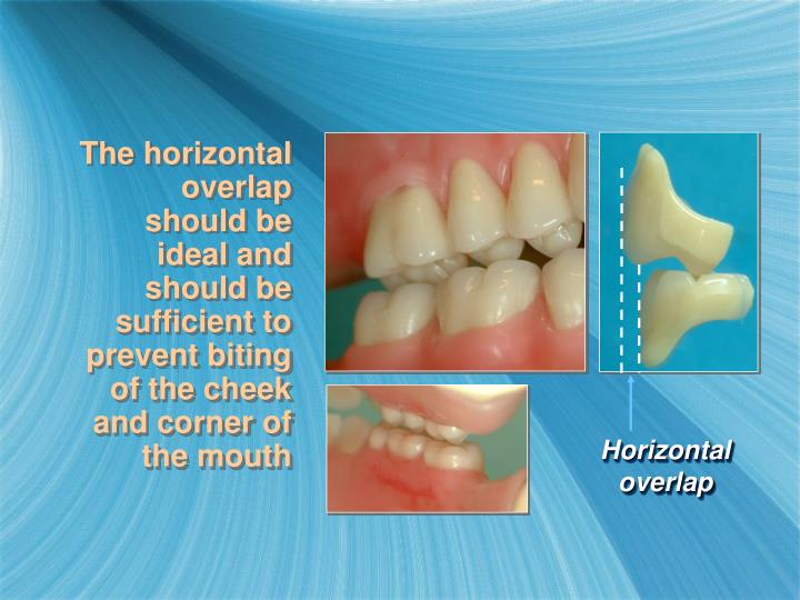 PPT - Setting Posterior Teeth PowerPoint Presentation - ID:4484665