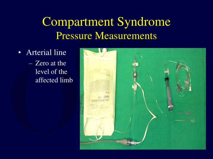 PPT - Compartment Syndrome PowerPoint Presentation - ID:4486574