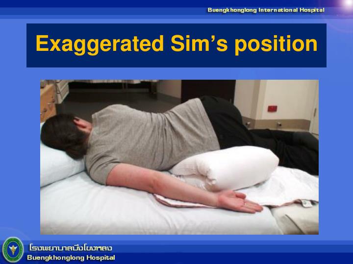 PPT - Umbilical cord prolapsed PowerPoint Presentation - ID:4487903