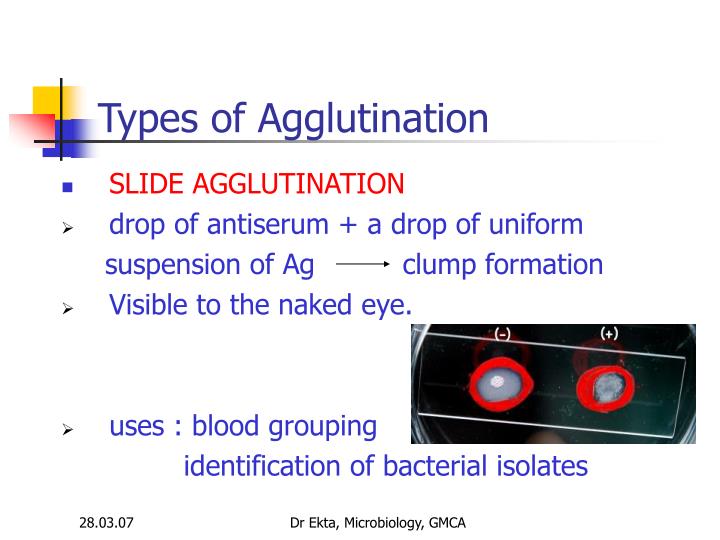 PPT - Serological Reactions PowerPoint Presentation - ID:4491488