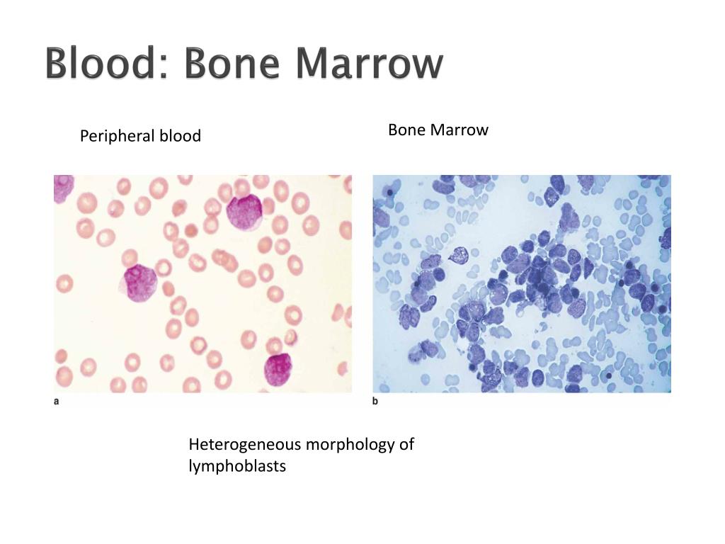 PPT - MLAB 1415: Hematology Keri Brophy-Martinez PowerPoint ...