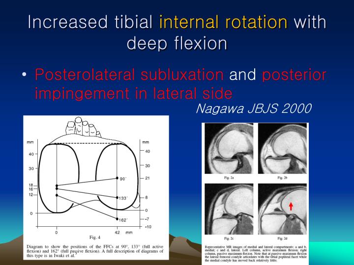 PPT - Primary TKA PowerPoint Presentation - ID:4493422