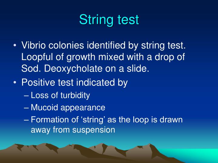 PPT - Vibrio cholerae PowerPoint Presentation - ID:4494882