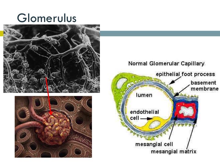PPT - Glomerular Diseases : Nephrotic and Nephritic Syndrome PowerPoint ...