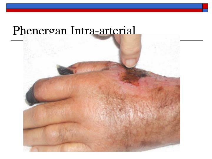 PPT - Complications of Intravenous Therapy PowerPoint Presentation - ID ...