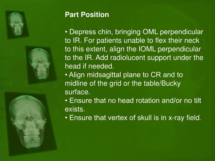 PPT - Positioning of the Skull PowerPoint Presentation - ID:4499009