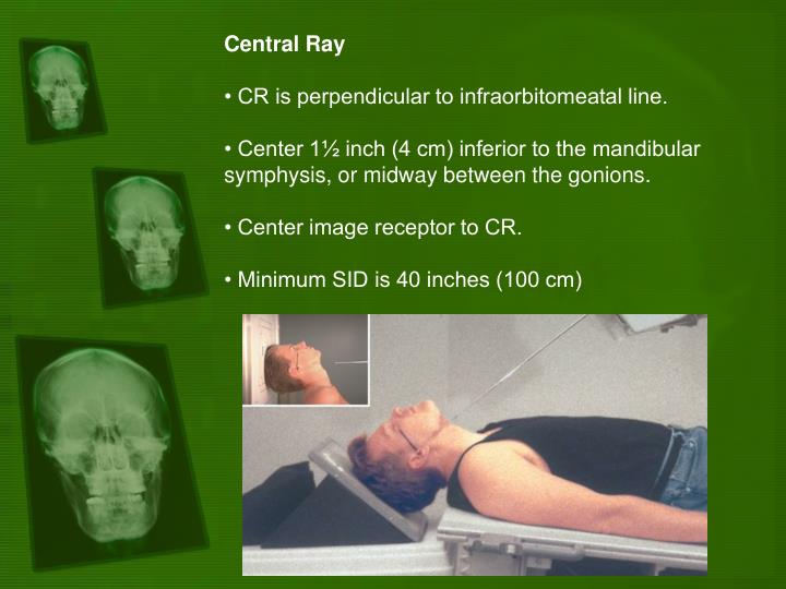 PPT - Positioning of the Skull PowerPoint Presentation - ID:4499009