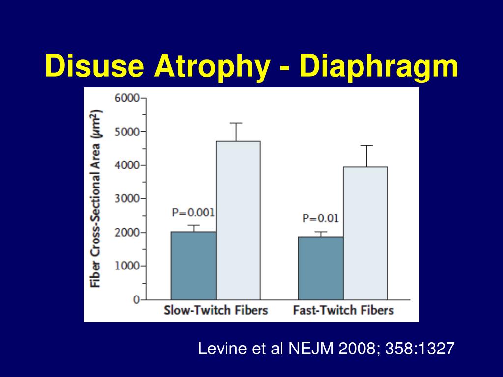 PPT - Poly-Neuropathy in Critical Care Patients PowerPoint Presentation ...