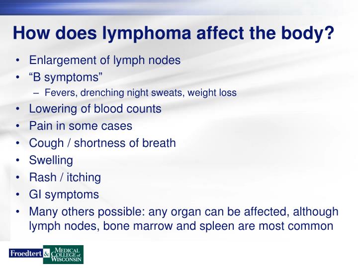PPT - Lymphoma Overview PowerPoint Presentation - ID:4501266