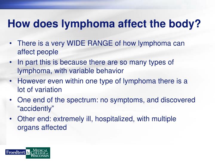 PPT - Lymphoma Overview PowerPoint Presentation - ID:4501266