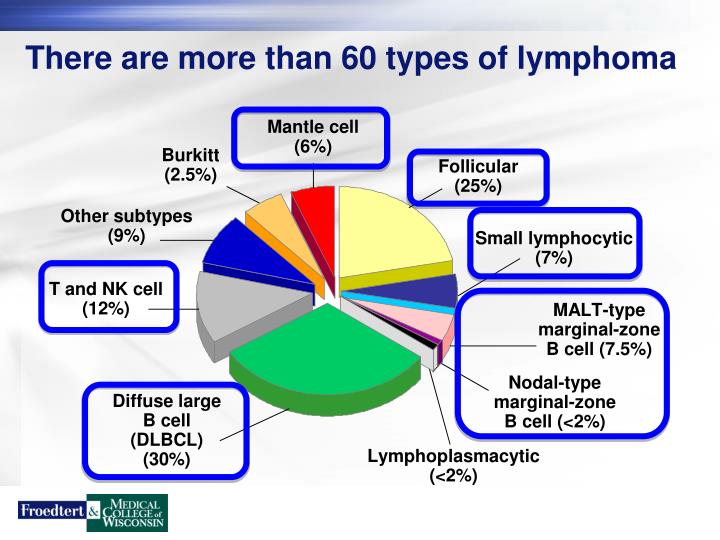 Ppt Lymphoma Overview Powerpoint Presentation Id4501266