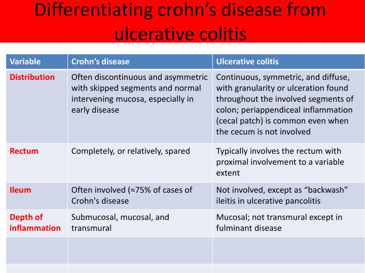 PPT - Ulcerative colitis PowerPoint Presentation - ID:4505529