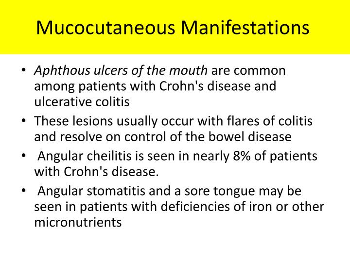 PPT - Ulcerative colitis PowerPoint Presentation - ID:4505529