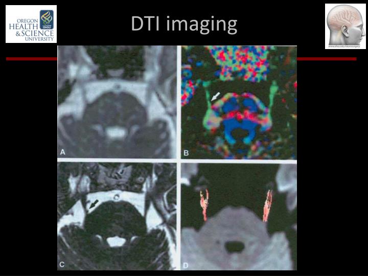 PPT - Facial Pain: Diagnosis and treatment PowerPoint Presentation - ID ...