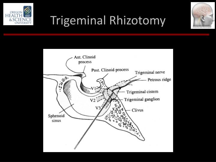 PPT - Facial Pain: Diagnosis and treatment PowerPoint Presentation - ID ...