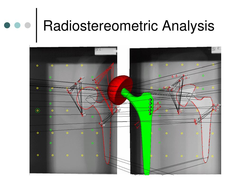 PPT - Presentasjon av to studier ved RSA-gruppen Kristiansund Sykehus ...