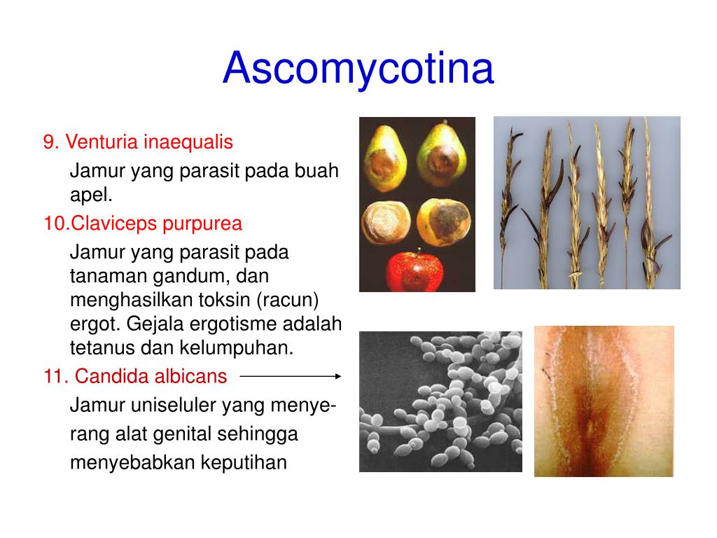 Ppt Bab Vi Jamur Powerpoint Presentation Free Download Id 4512689