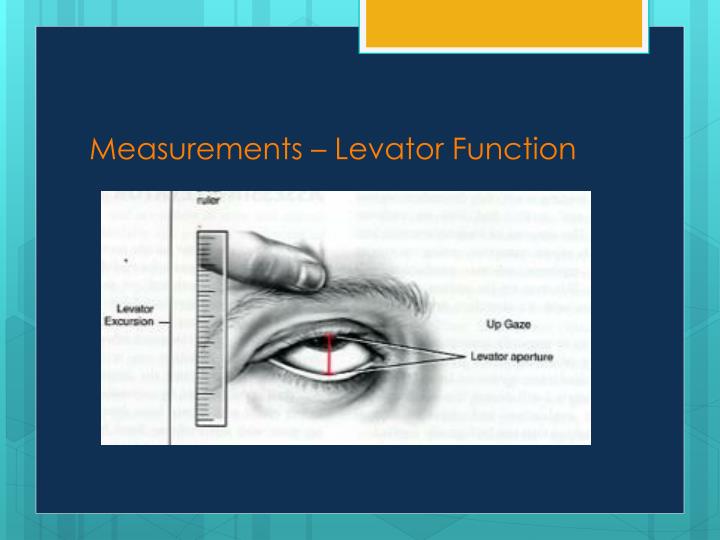 PPT - Management of Ptosis in OPMD PowerPoint Presentation - ID:4512824