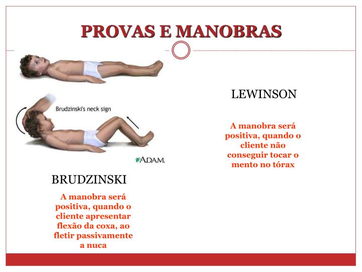 PPT - Semiologia do sistema nervoso PowerPoint Presentation - ID:4513605