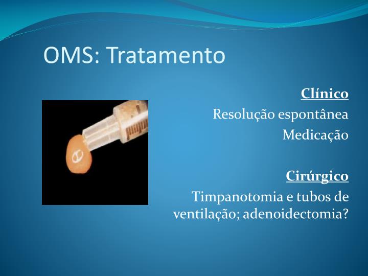PPT - OTITES 1. Otite Externa 2. Otite Média PowerPoint Presentation ...