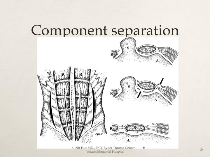 PPT - Laparoscopic Vs Open repair in patients with 1 O ventral or ...