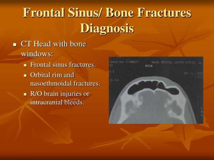 PPT - Maxillofacial trauma PowerPoint Presentation - ID:4518457